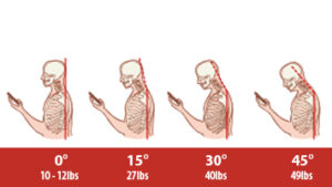 Chiropractic Helps Posture - Chiros Hub